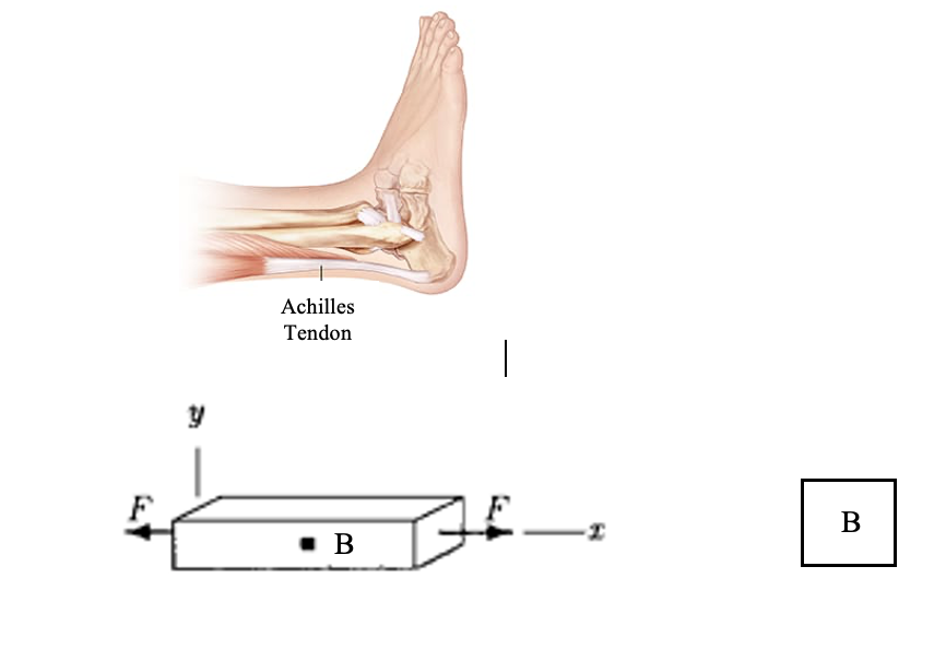 Solved Case Scenario 2- Achilles Tendon Loading You are | Chegg.com