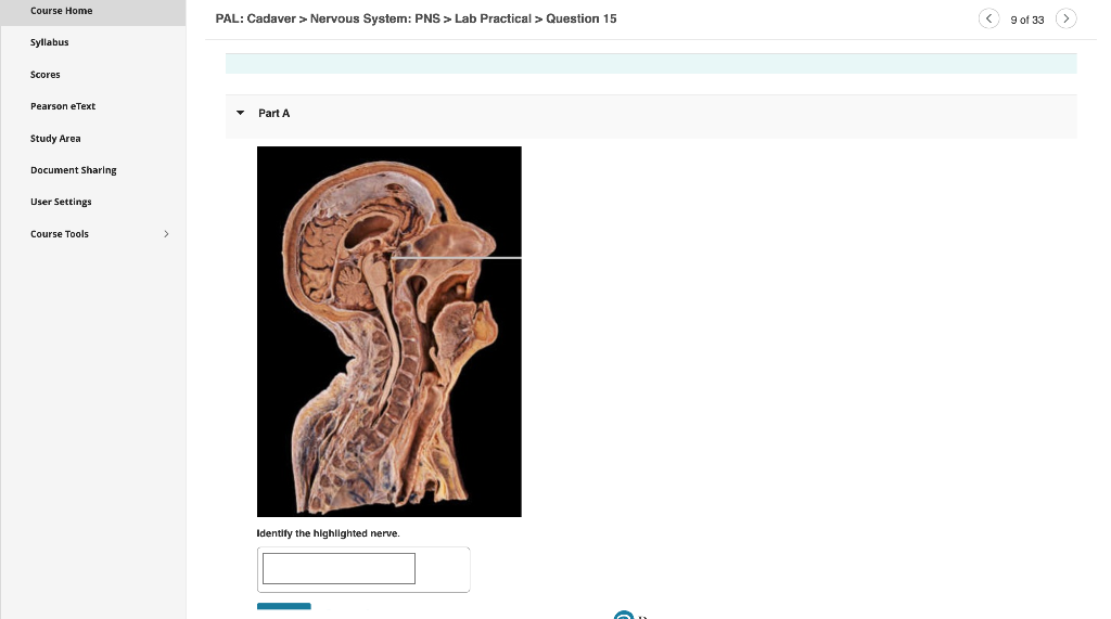 Solved PAL: Cadaver > Nervous System: PNS > Lab Practical > | Chegg.com