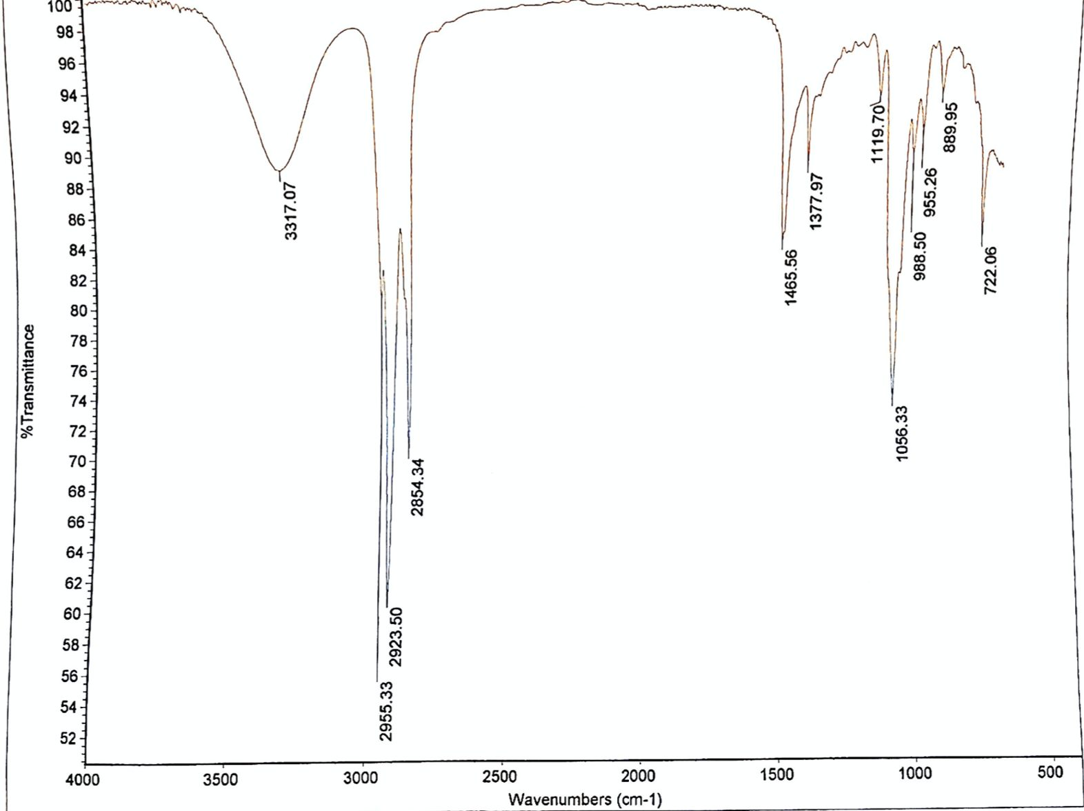 Solved What 3 IR peaks show the presence of an ester? | Chegg.com