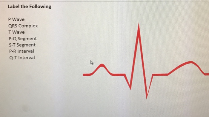 Solved Label The Following P Wave Qrs Complex T Wave P Q