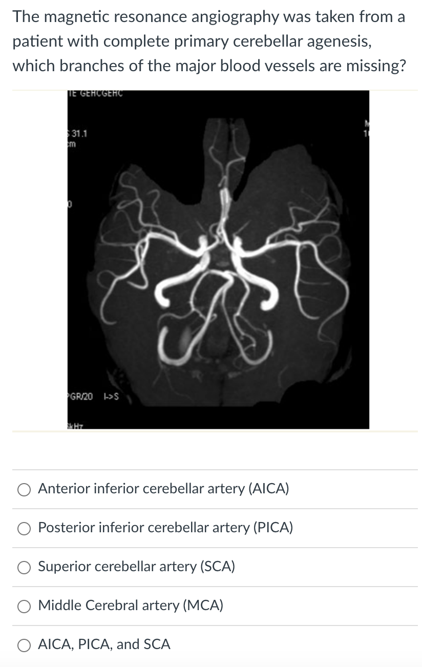 Solved The magnetic resonance angiography was taken from a | Chegg.com