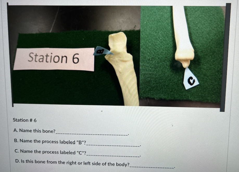 Solved A. Name this bone? B. Name the process labeled "B"? | Chegg.com