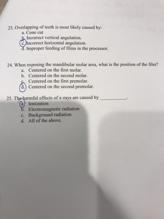 Solved 23. Overlapping of teeth is most likely caused by: a. | Chegg.com