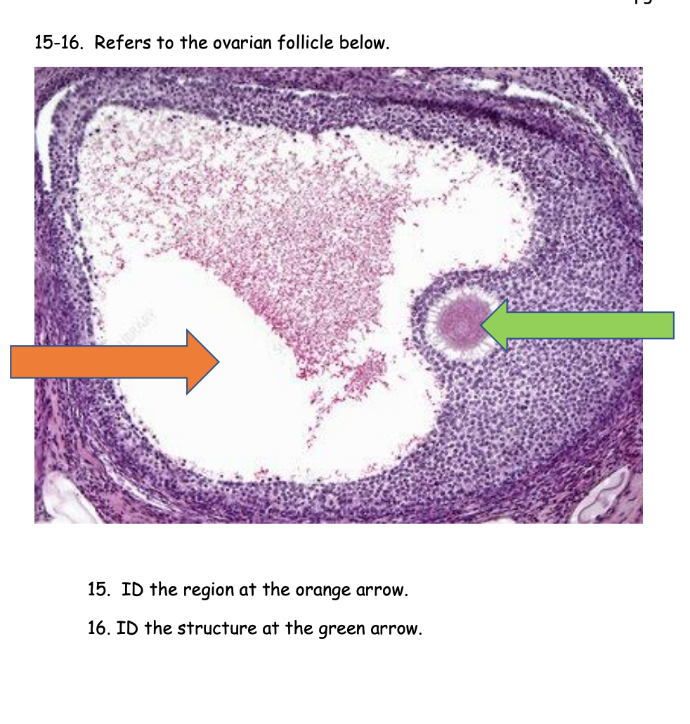 Solved located in the 13. The cells represented at the | Chegg.com