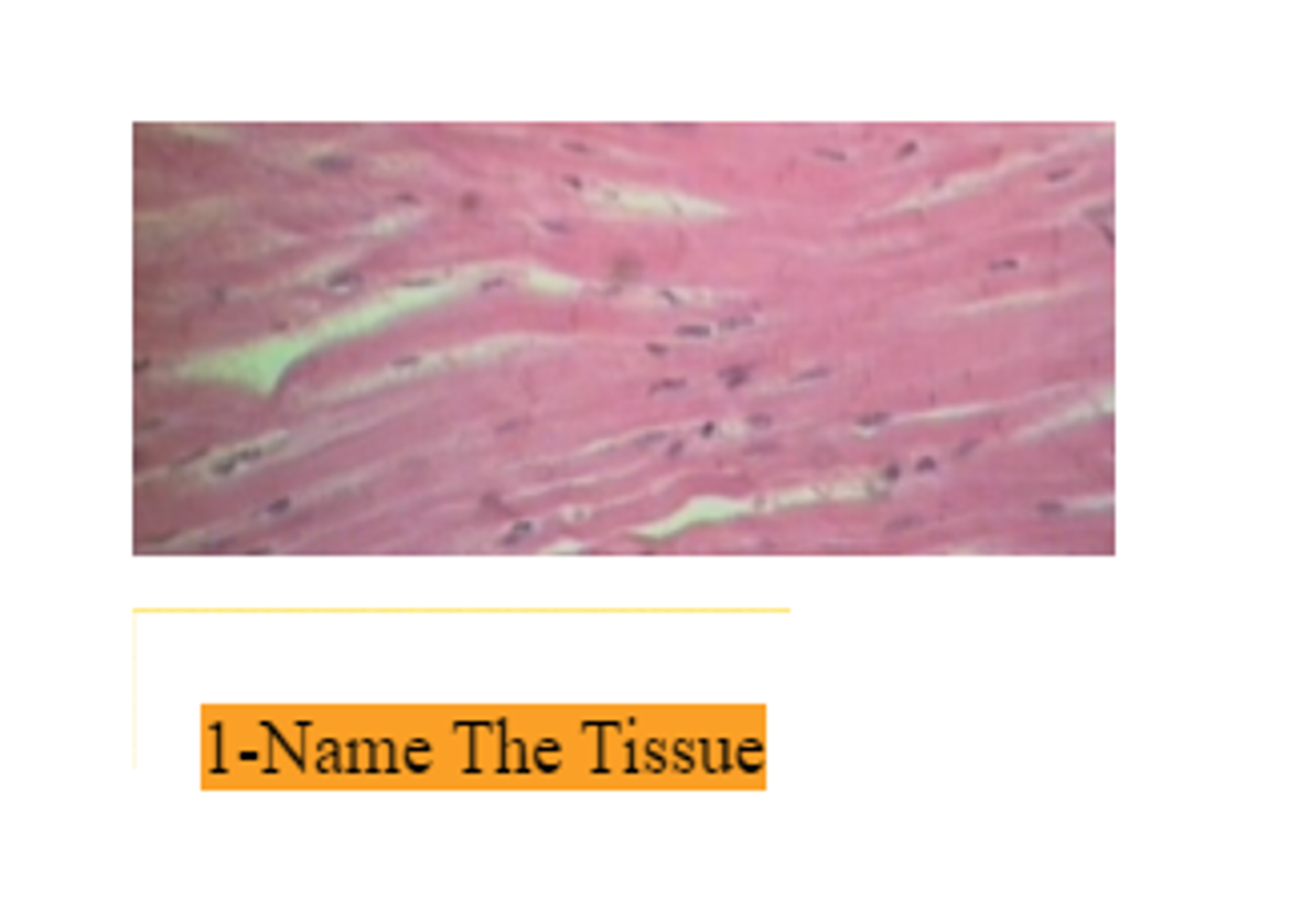 Solved 1-Name The Tissue | Chegg.com