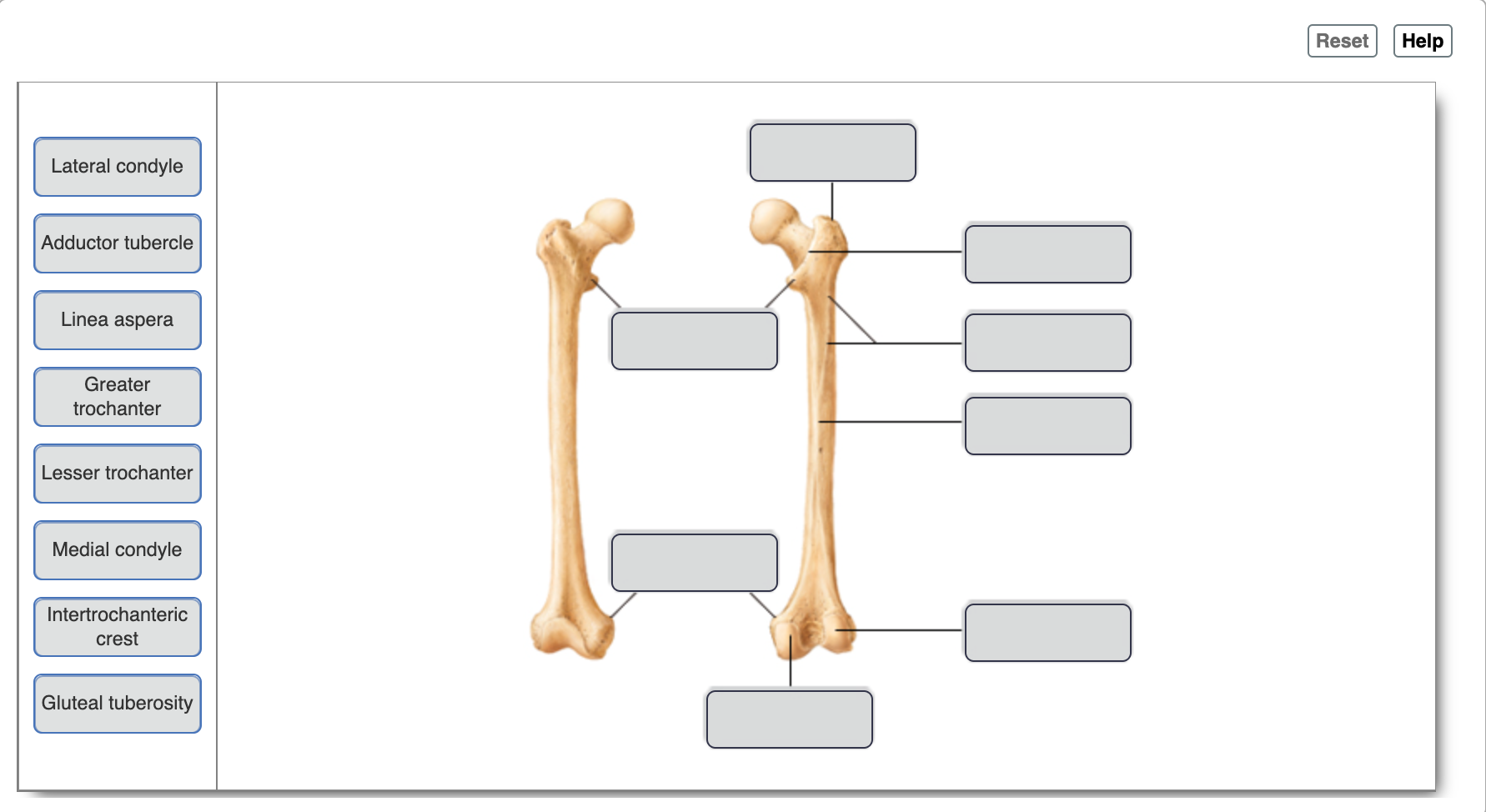 Solved Reset Help Lateral condyle Adductor tubercle Linea | Chegg.com