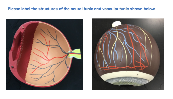 Solved Please label the structures of the neural tunic and | Chegg.com