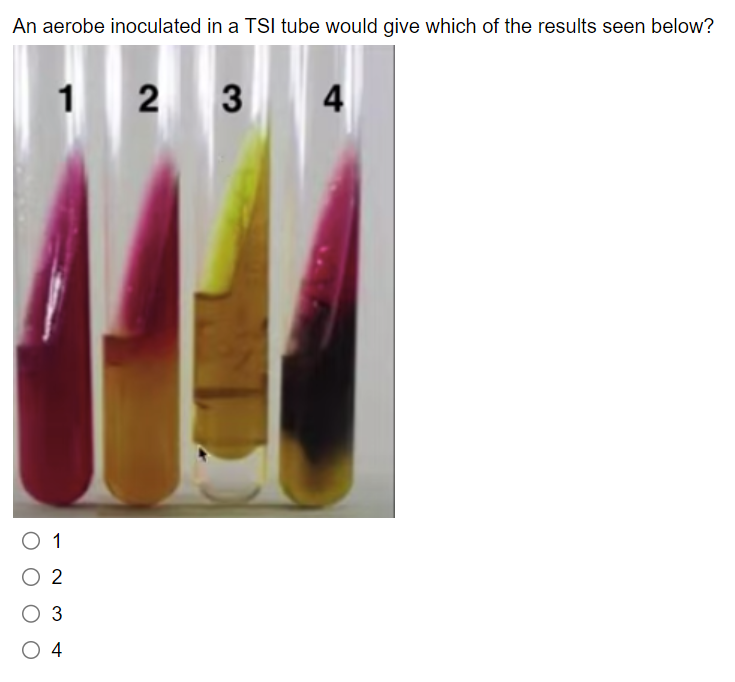 Solved An aerobe inoculated in a TSI tube would give which | Chegg.com