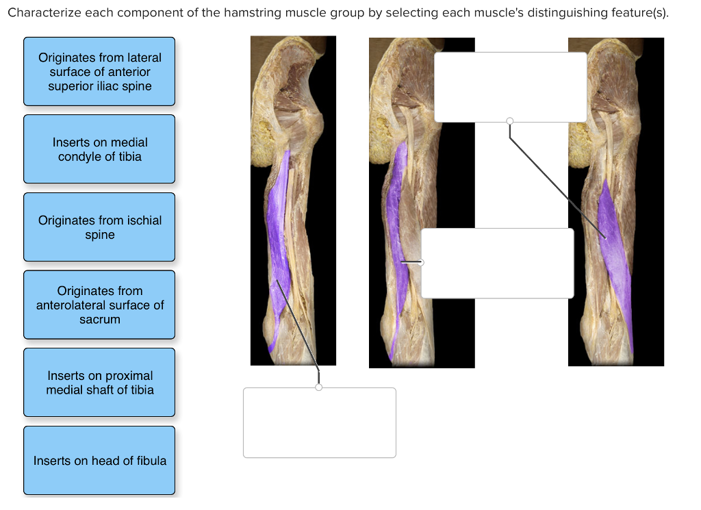 Solved Characterize each component of the hamstring muscle | Chegg.com