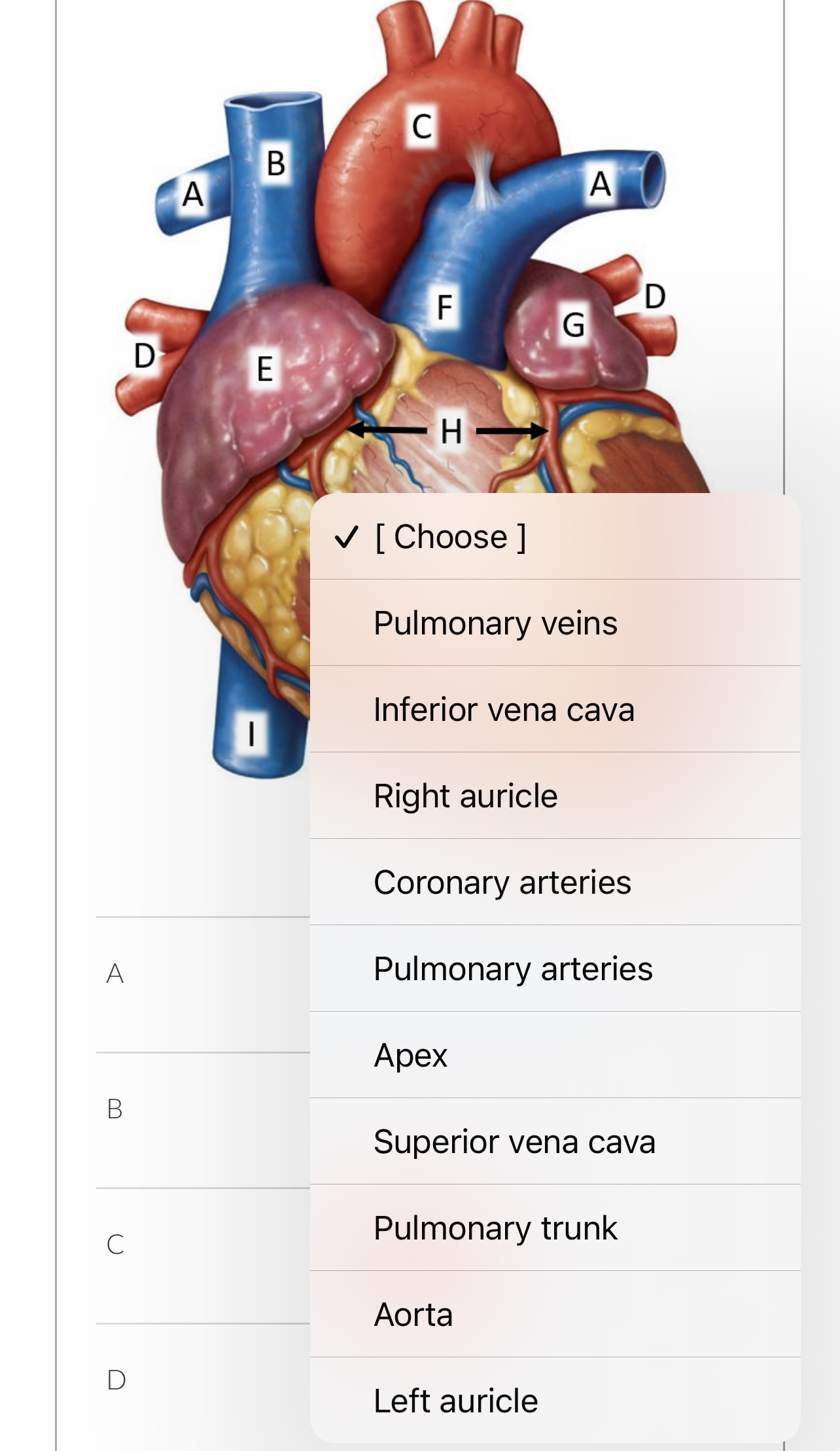 Solved Pulmonary veins Inferior vena cava Right auricle | Chegg.com