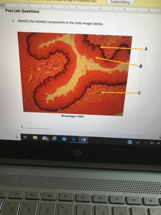 Solved Enable Editing Post-Lab Questions 1. Identify the | Chegg.com