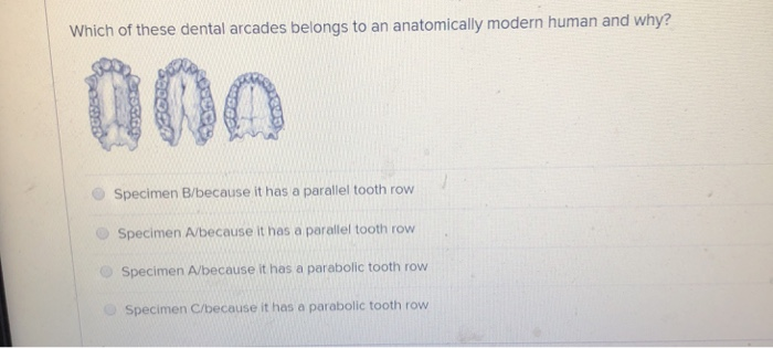 Solved Which of these dental arcades belongs to an | Chegg.com
