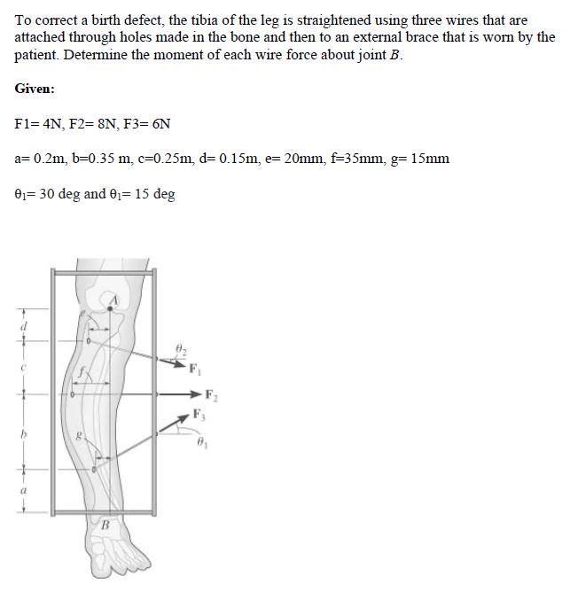Solved To correct a birth defect, the tibia of the leg is | Chegg.com