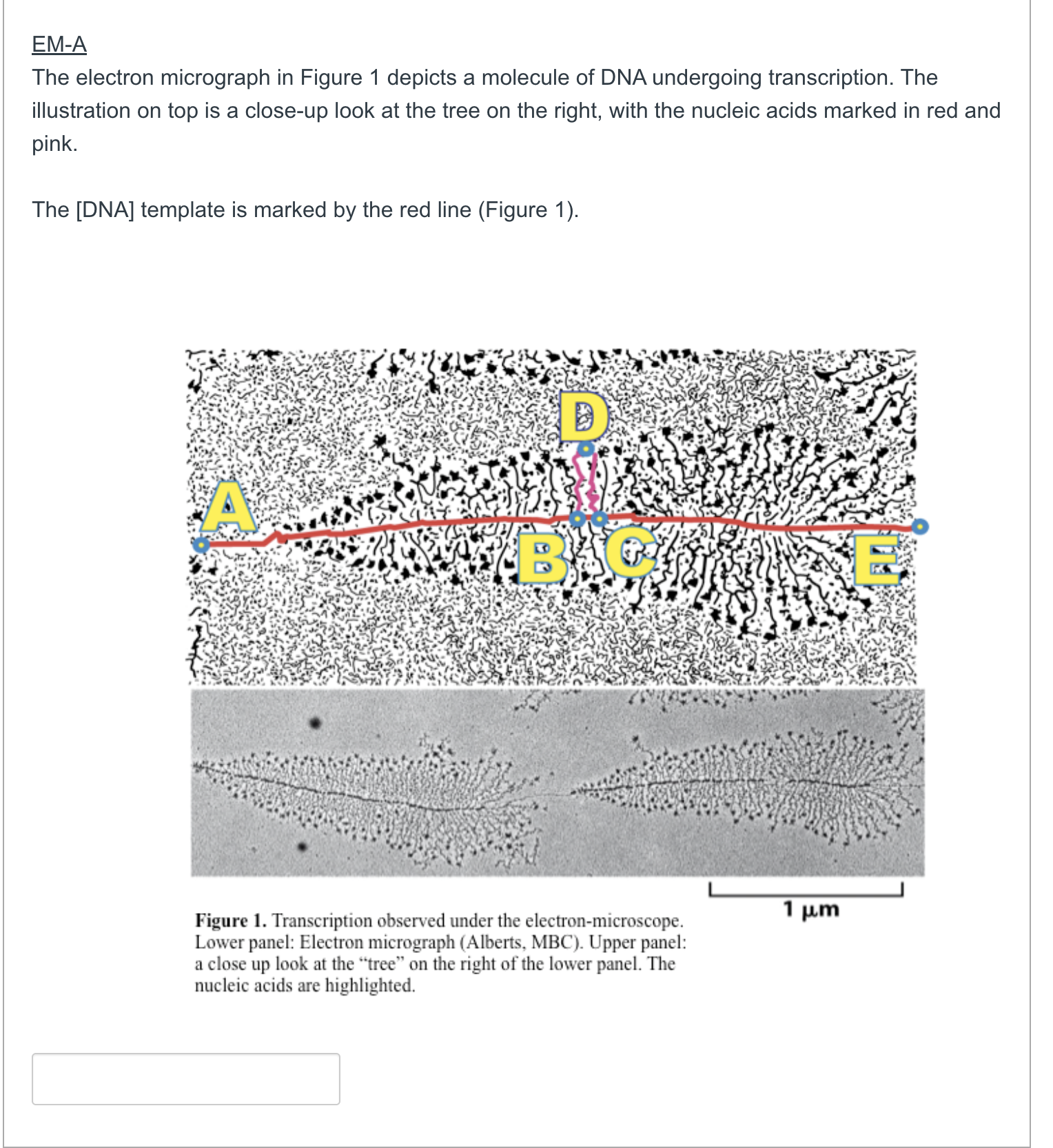 EM-A The electron micrograph in Figure 1 depicts a | Chegg.com