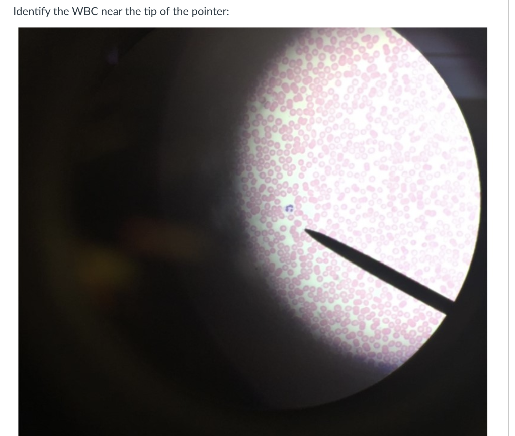 Solved Identify the structure at the tip of the pointer: | Chegg.com