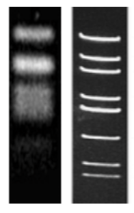 Solved Below are two profiles of the same pUC18 HaeIII | Chegg.com