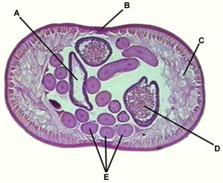 Leech Cross Section