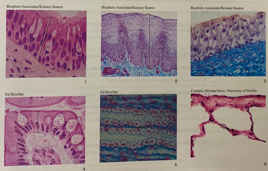 Solved Identify the epithelia (1 -6) and connective tissue | Chegg.com