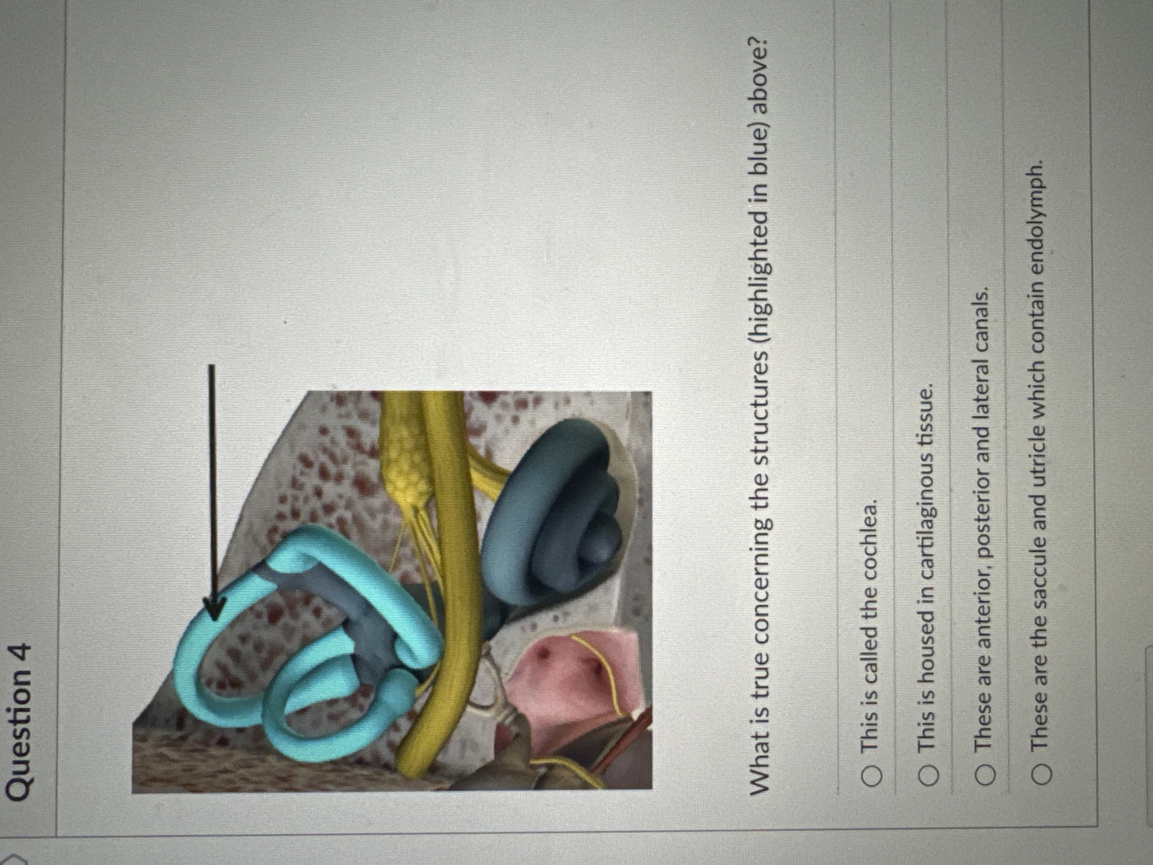 Solved Question 4What is true concerning the structures | Chegg.com