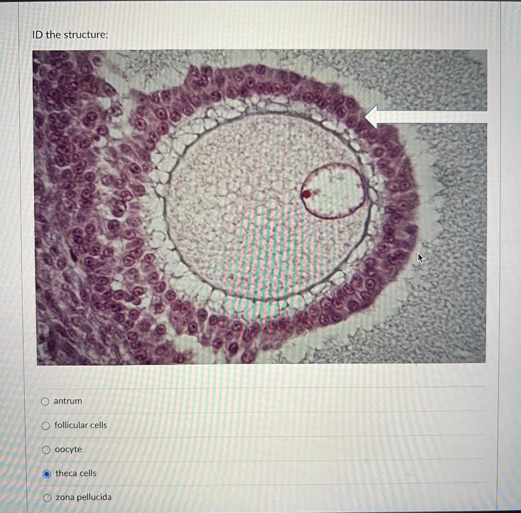Solved ID the structure: O antrum follicular cells O oocyte | Chegg.com