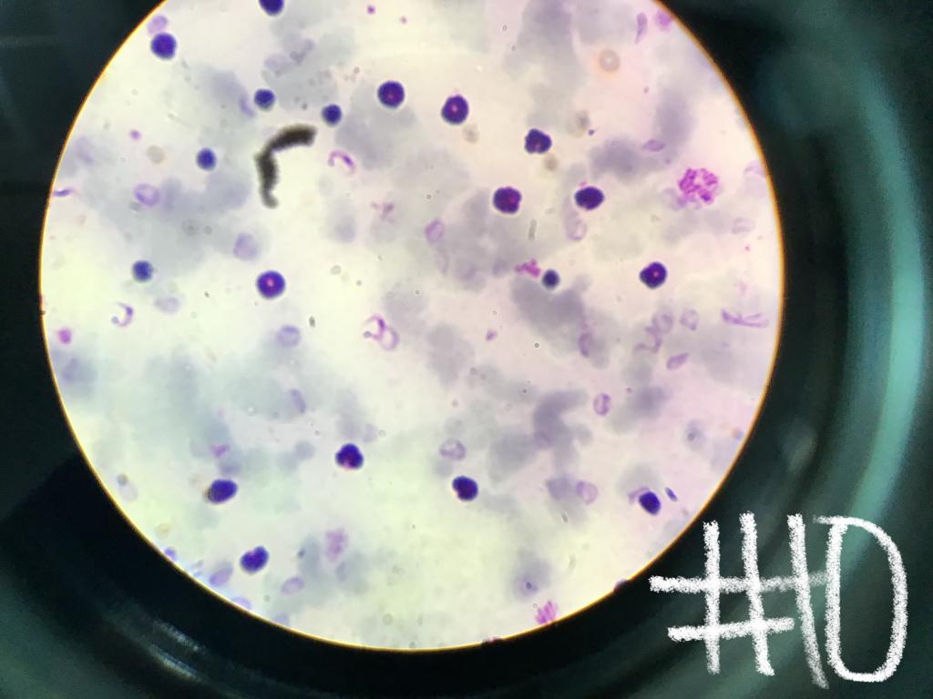 Solved Microscope slide #8 Fecal smear – unspecified stain | Chegg.com