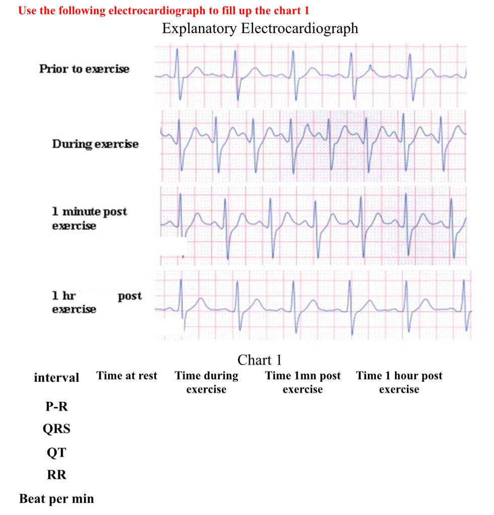 Solved Use the following electrocardiograph to fill up the | Chegg.com