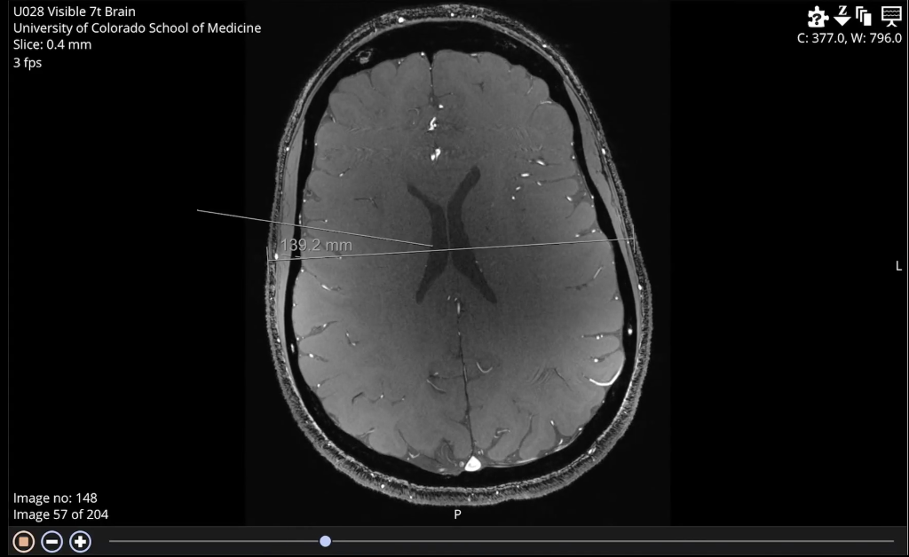 Solved MRI MRI MRI MRI U028 Visible 7t Brain | Chegg.com