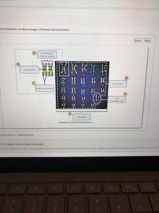 Solved rect locations on these images of human chromosomes | Chegg.com