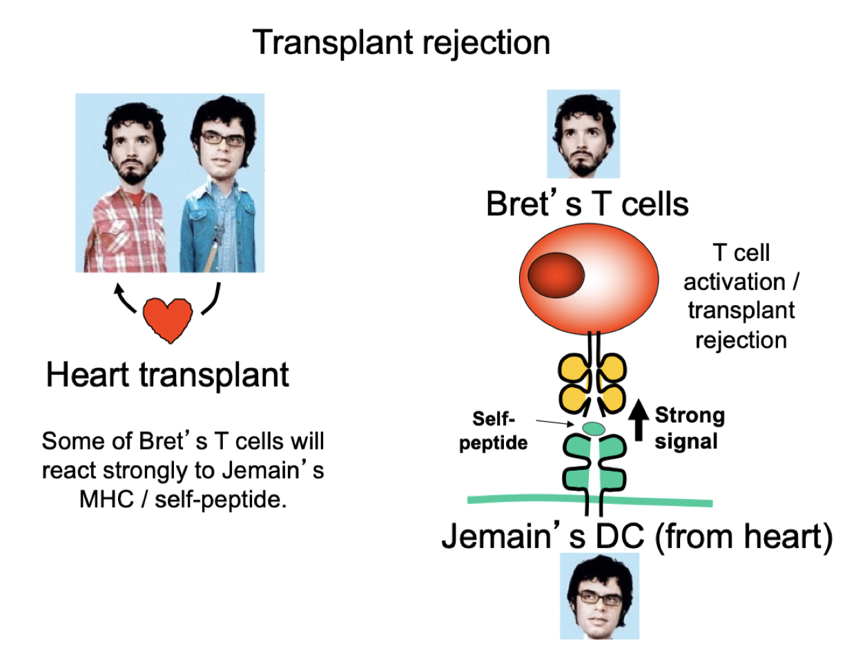 Solved Transplant rejection and MHC - MHC are the most | Chegg.com
