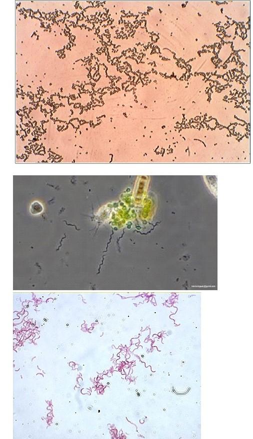 Solved . Identify the different types of bacteria according | Chegg.com