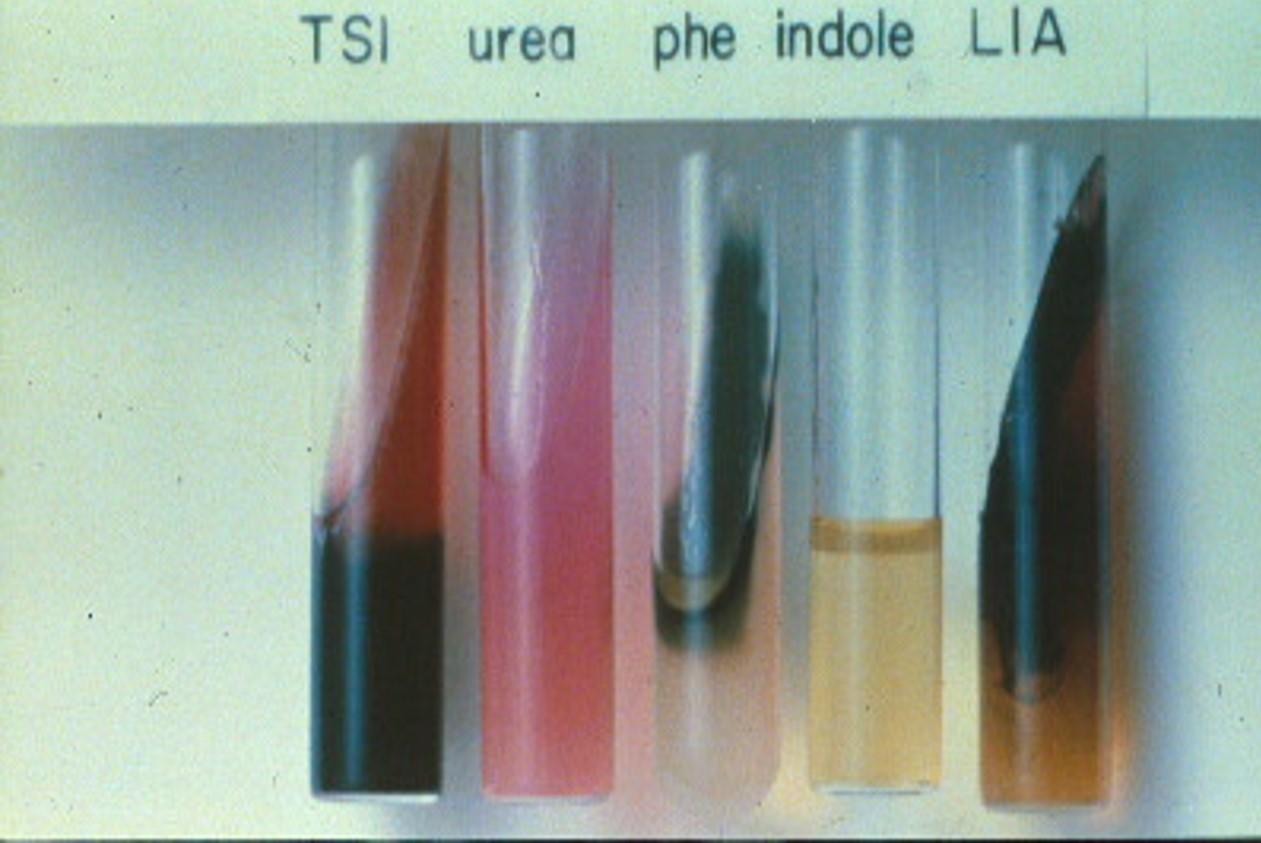 Solved TSI urea phe indole LIA | Chegg.com