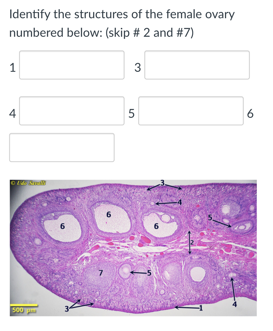 Solved Identify the structures of the female ovary numbered | Chegg.com