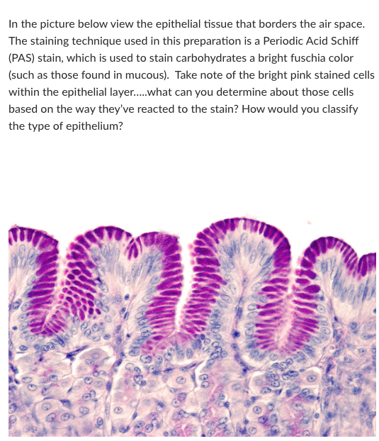 Solved In the picture below view the epithelial tissue that | Chegg.com
