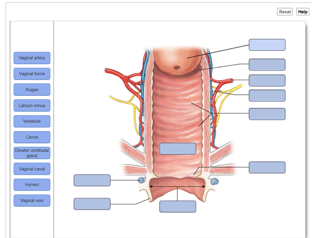 Solved Art-labeling Activity:Label the anatomical features | Chegg.com