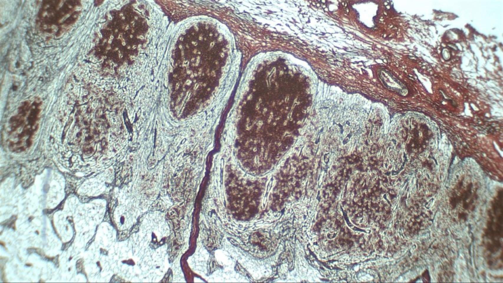 Solved Label the capsule, medulla, cortex, nodule, and | Chegg.com