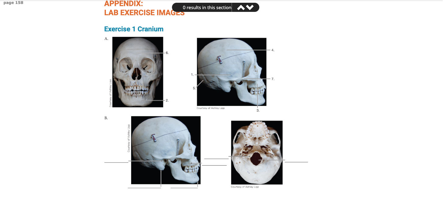 Solved page 158 APPENDIX: LAB EXERCISE IMAGES O results in | Chegg.com
