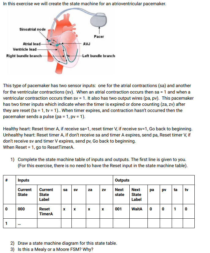 Solved This type of pacemaker has two sensor inputs: one for | Chegg.com