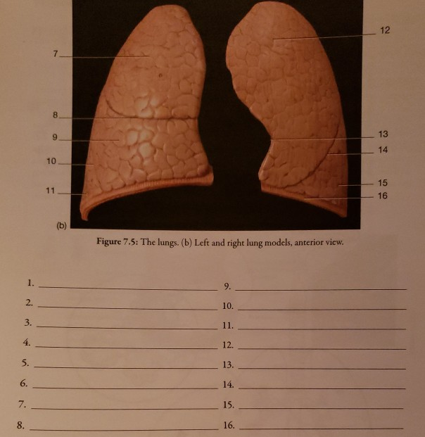 Solved Vertebra Esophagus in posterior mediastinum) | Chegg.com