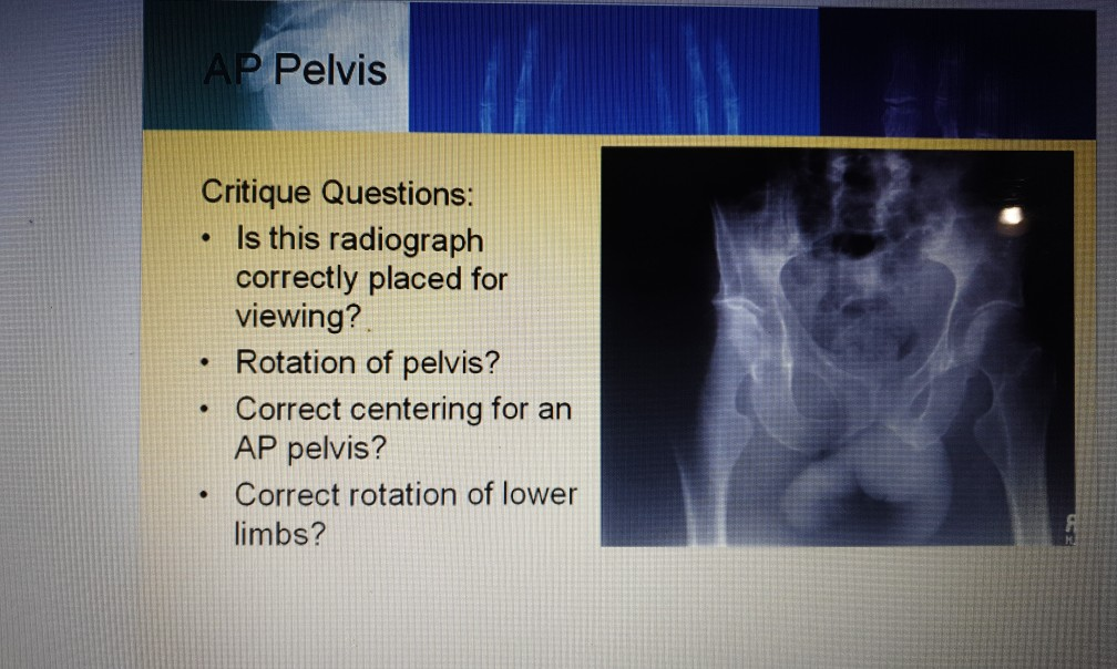 Solved AP Pelvis Critique Questions: Is this radiograph | Chegg.com