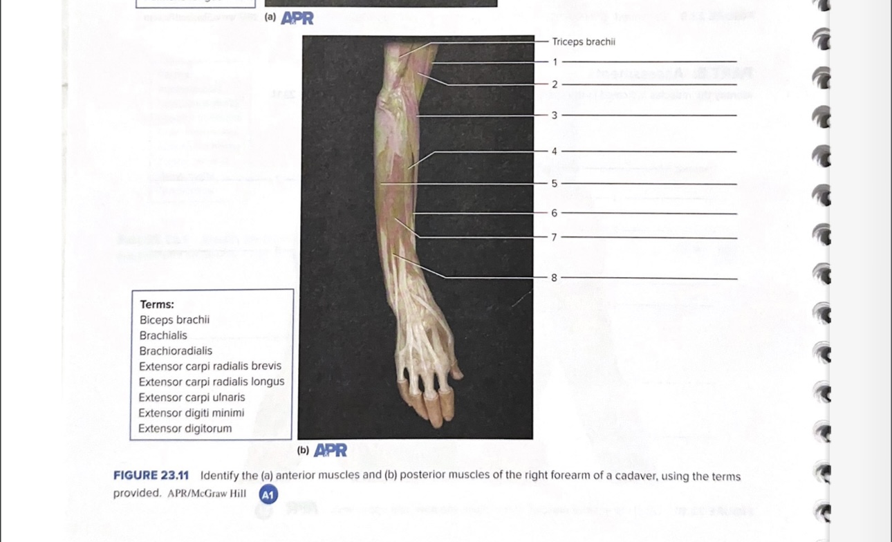 Solved FIGURE 23.11 Identify the (a) anterior muscles and | Chegg.com