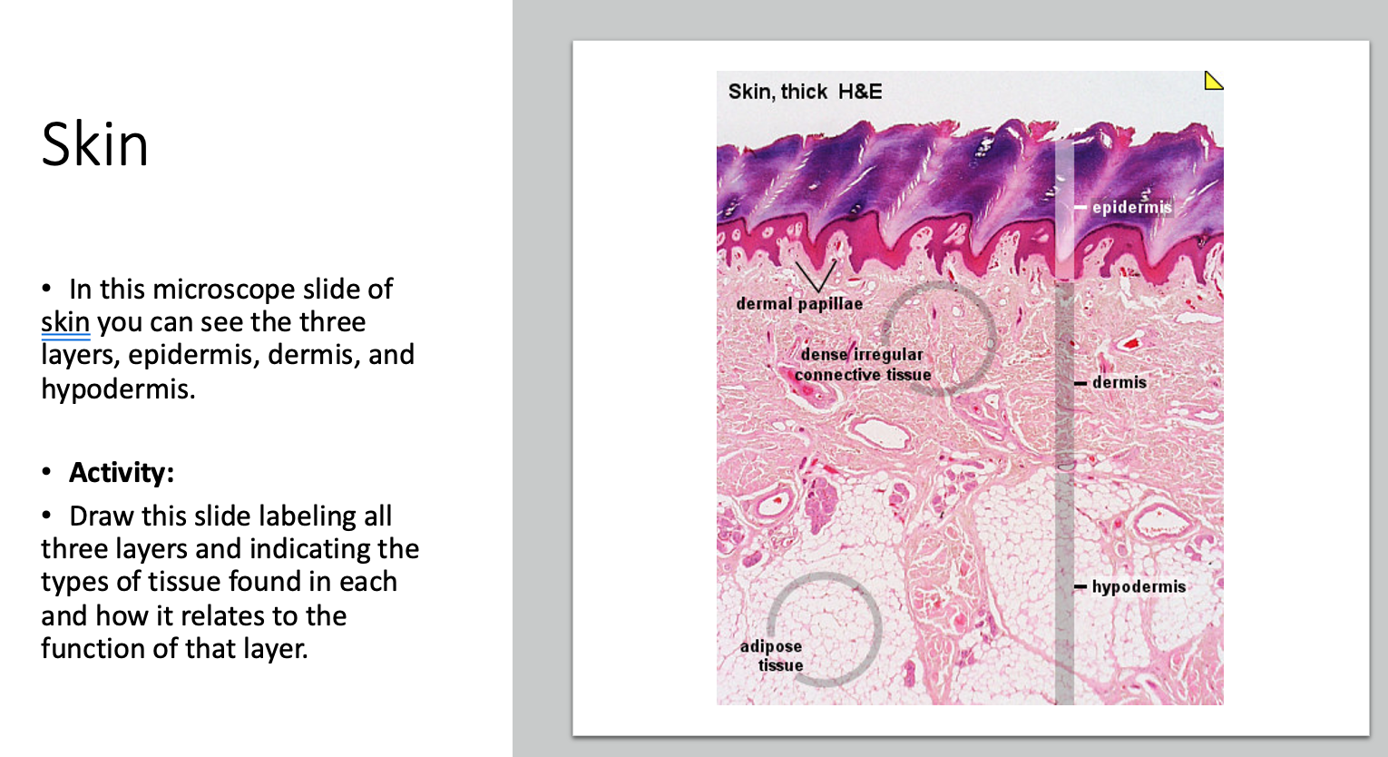 Solved Skin, thick H&E Skin epiderinis dermal papillae • In | Chegg.com