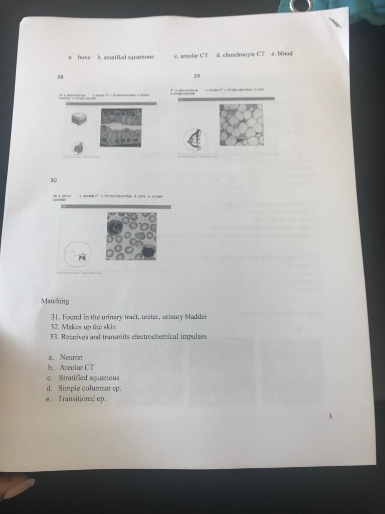 Solved Spring 2019 MIC hiol 201 Quia #2 Matching a columnar | Chegg.com