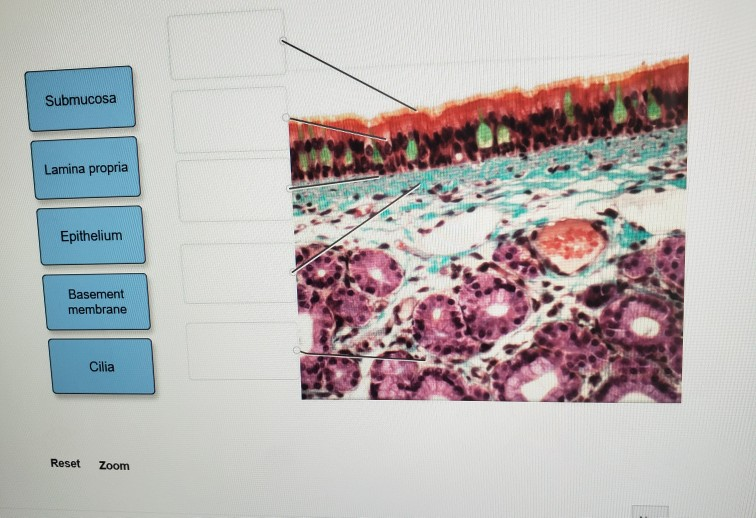 Solved Kidney Ureter perirenal fat Suprarenal gland Urinary | Chegg.com