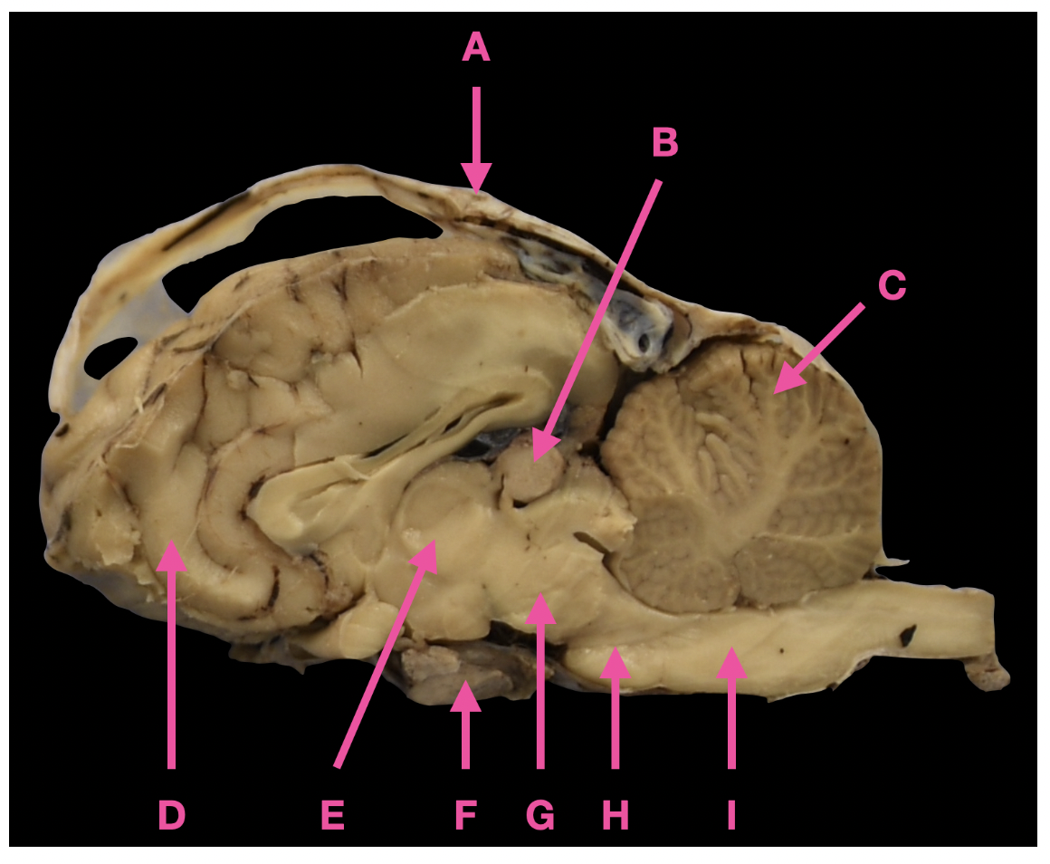 Identify all regions of the brain. | Chegg.com Identify all regions of the brain. | Chegg.com