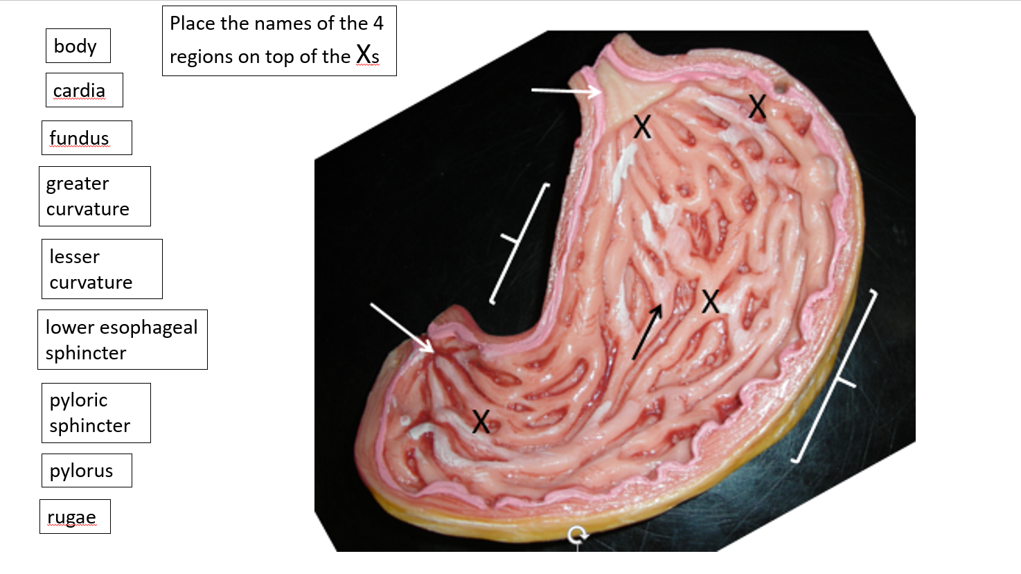Stomach Fundus Slide Labeled