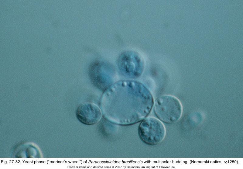 Paracoccidioides Brasiliensis Mold