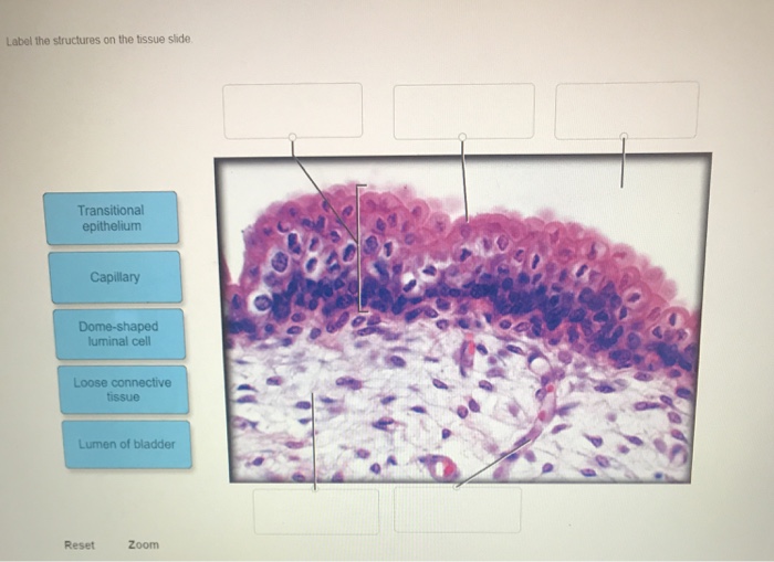 Solved Label the structures on the tissue slide Transitional | Chegg.com