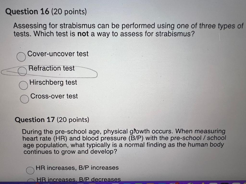 Solved Assessing for strabismus can be performed using one | Chegg.com