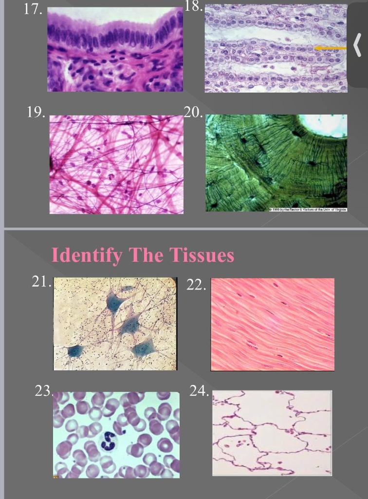 Solved Identify The Tissues 2. 3. Identify The Tissues 16. | Chegg.com