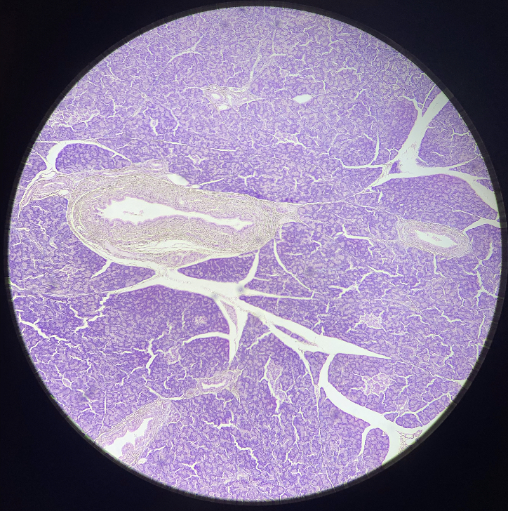 Solved The picture above is a close-up of the Pancreas. Can | Chegg.com